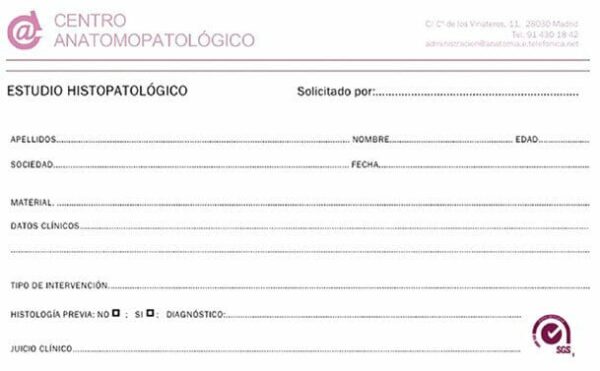 Protocolo de toma de biopsias en Odontología | Odontologos de Hoy